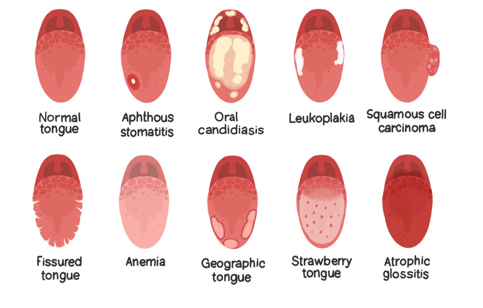 Oral Pathology - Dr. Brien Hsu